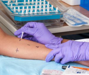 What is MCAD- Mast Cell Activation Diseases- Oh TWIST